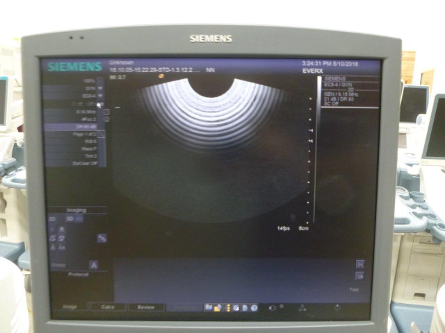 Siemens Antares - Premium Edition - MedNux | The home for Medical solutions