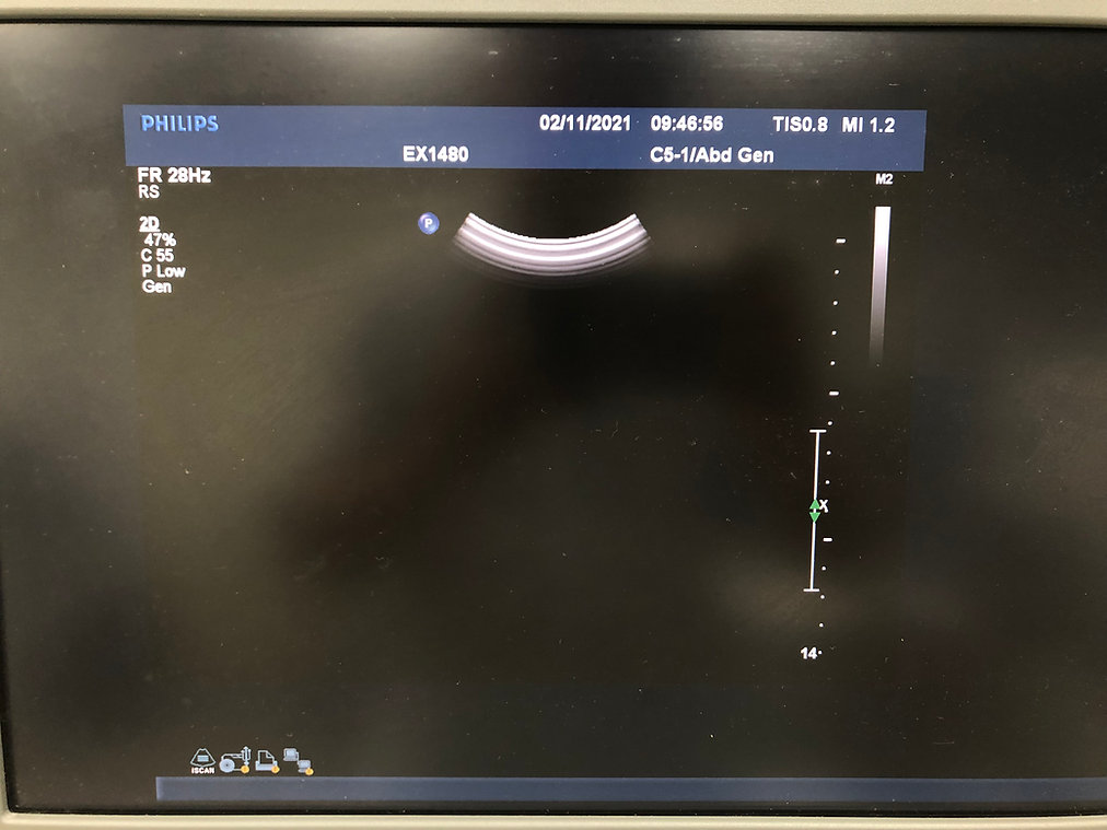 Ultrasound Probes - C5-1 - MedNux - The home for Medical solutions